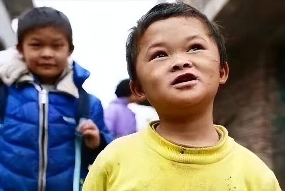 The 15-year-old "Little Ma Yun" has problems with food and clothing ...