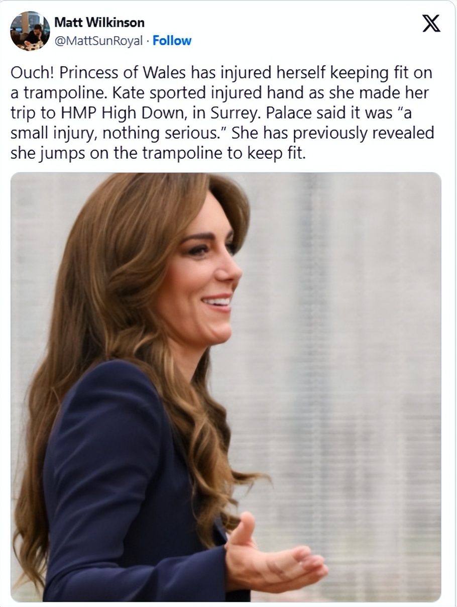 Kate Middleton suffers 'minor' injury - iMedia