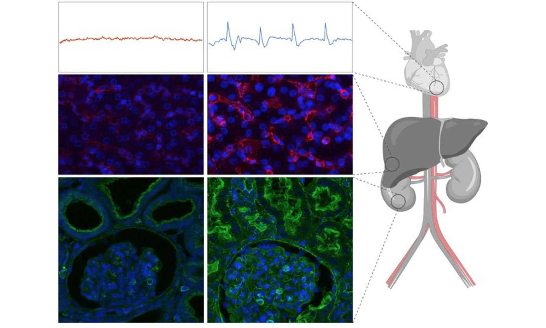 Scientists develop OrganEx system to restore organ function in pigs 1 ...