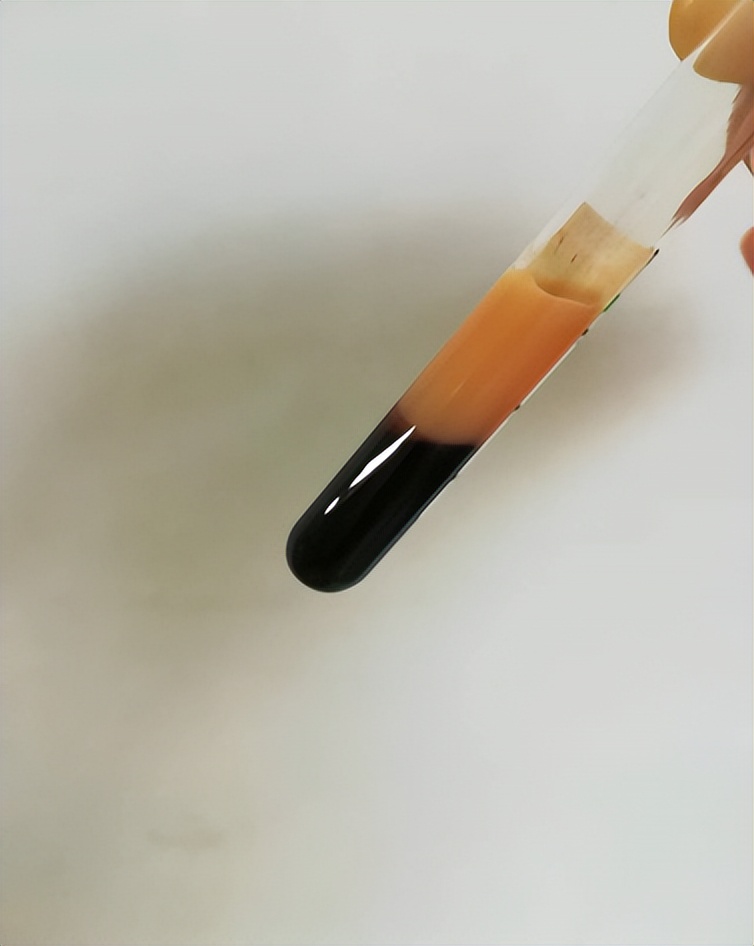 It's all about obesity - iNEWS