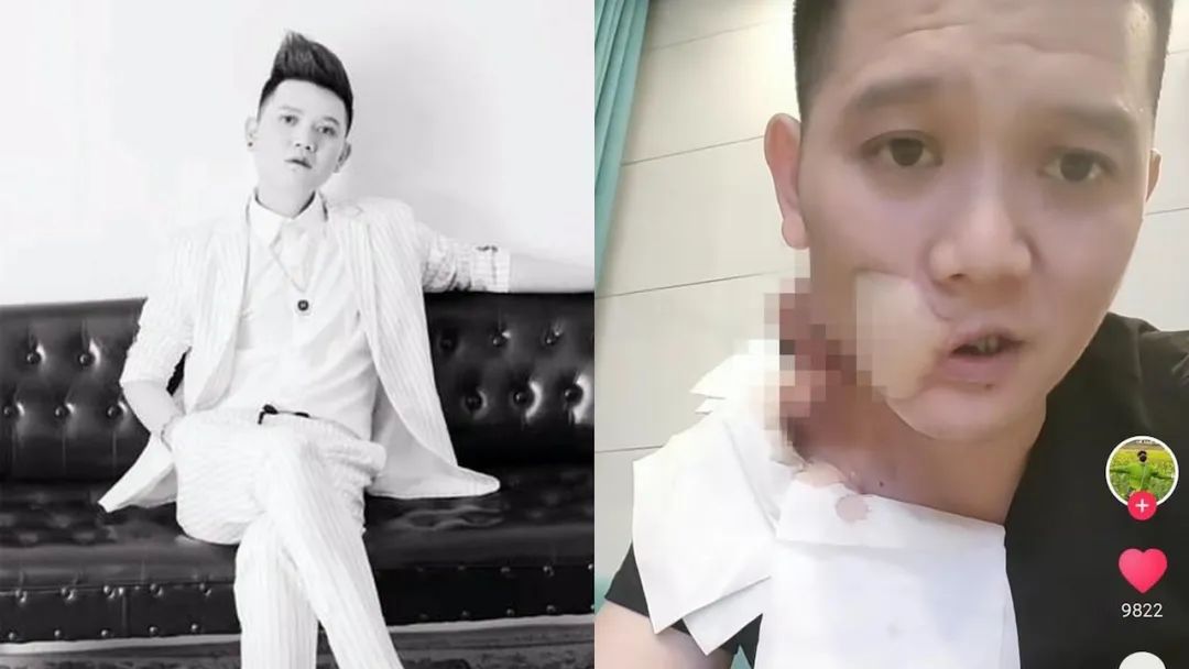 The 36-year-old singer died of cancer, and the cause was exposed: this ...