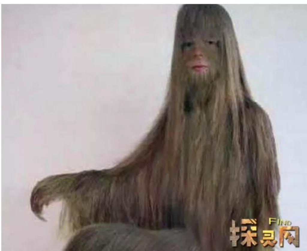 Emily Susan, the woman with the longest body hair in the world - iMedia