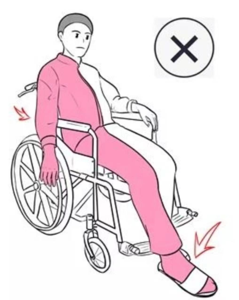 The importance and method of good limb placement in stroke patients ...