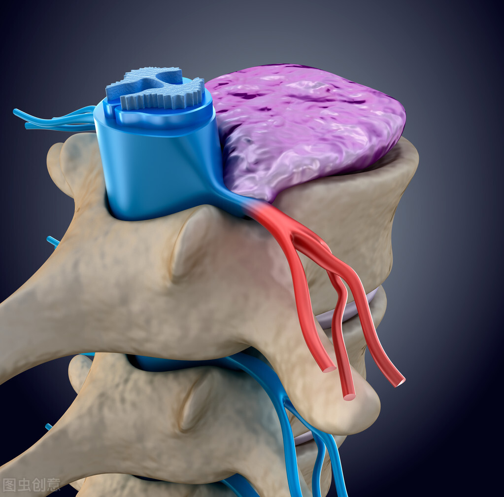 Interventional minimally invasive treatment of lumbar facet joint ...