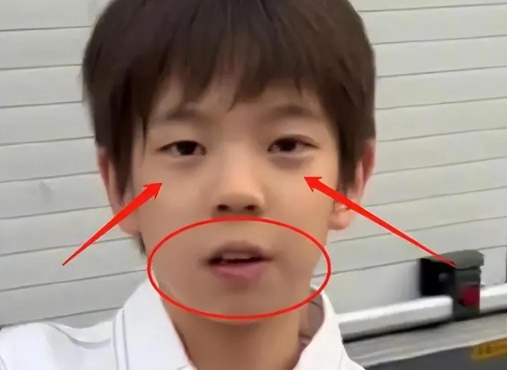 Huo Siyan denies that it is an adenoid face! The children of Liu ...