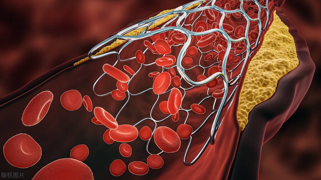 More walking is good for blood vessels? Doctor's Advice: After the age ...
