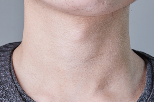 The body has cancer, the neck will know?There are 3 signs of neck, or ...