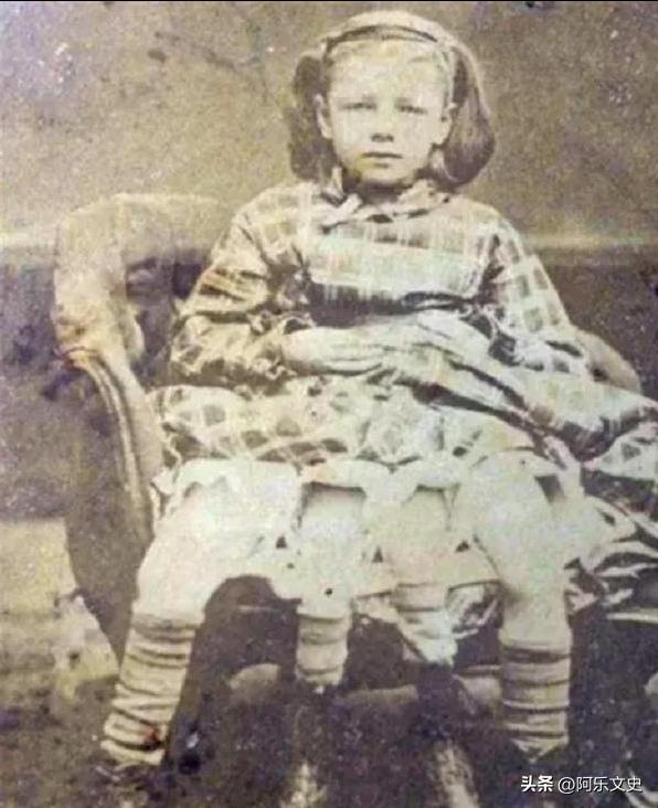 The lucky deformed child in the United States was born with 4 legs, has ...