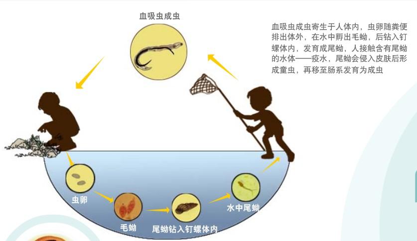 Professor Huang Jianrong Advances In The Diagnosis And Treatment Of