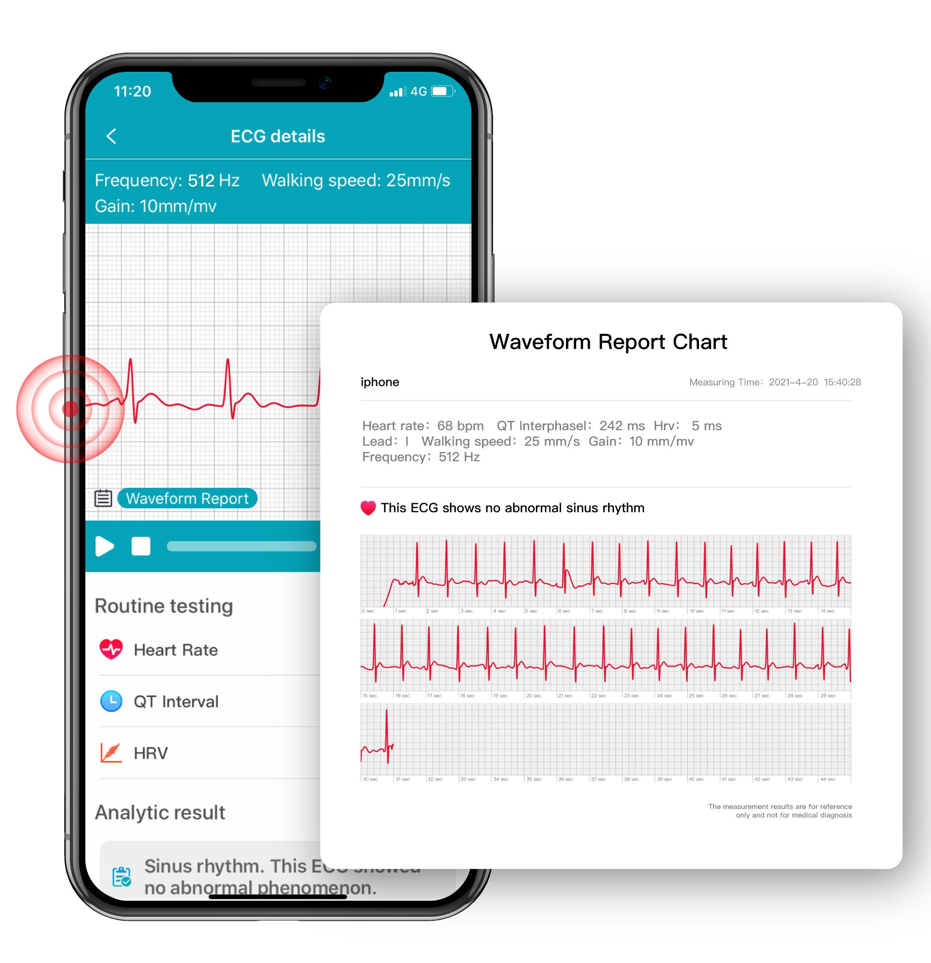 How does a smart watch realize ECG monitoring? - iMedia