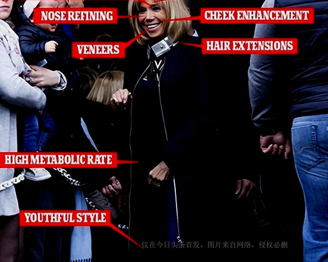 The beautiful first lady of France underwent 3 hours of facial surgery ...