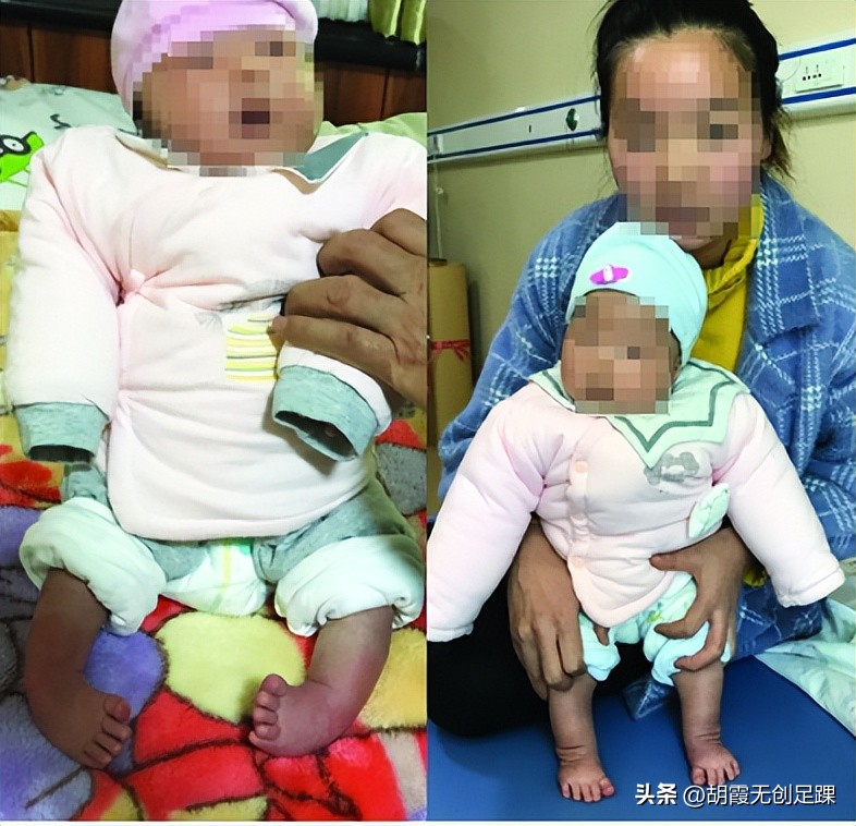 What should be checked for foot deformities - iNEWS