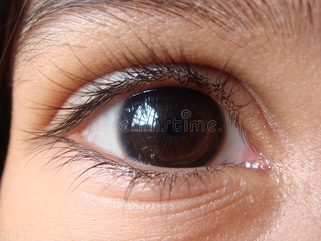 sunken eye sockets as you get older - iNEWS