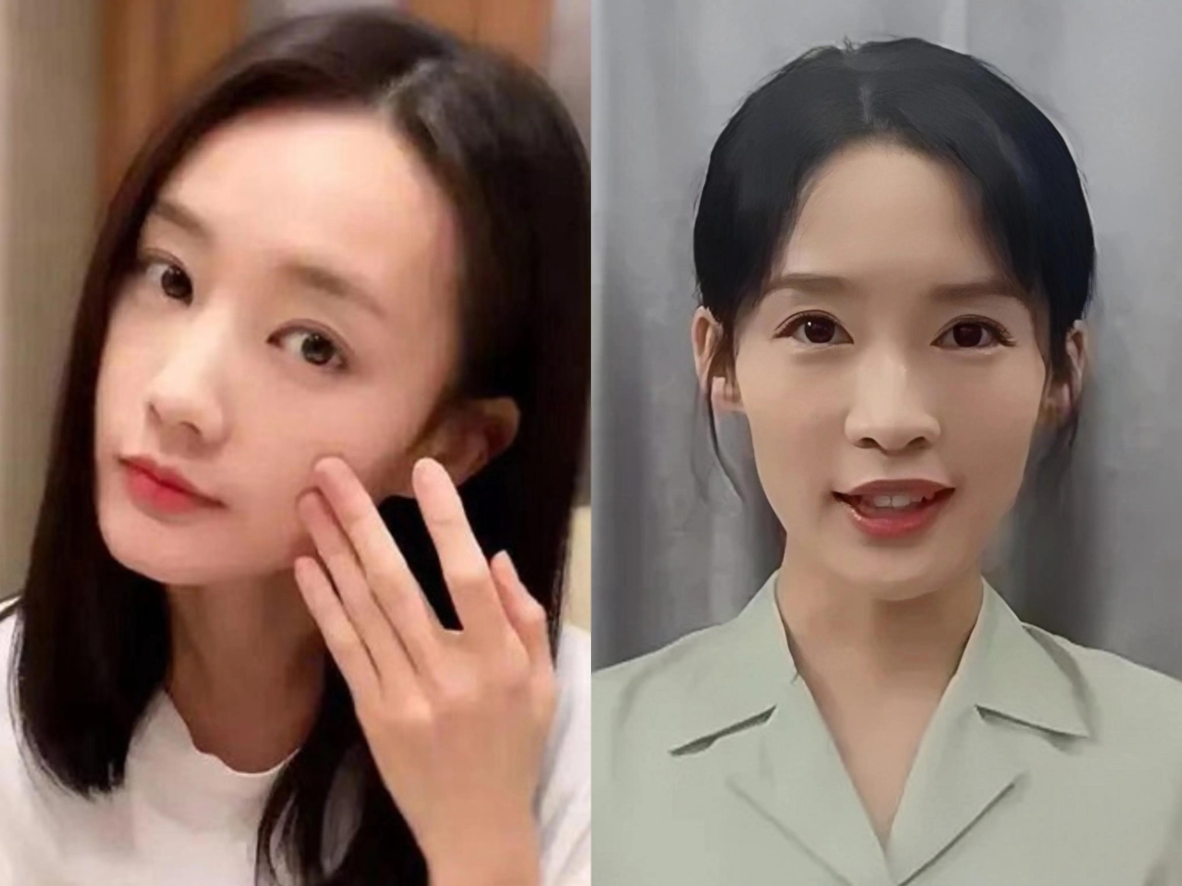 Out of shape! Li Qin's mouth is crooked, collagen is lost on his face ...