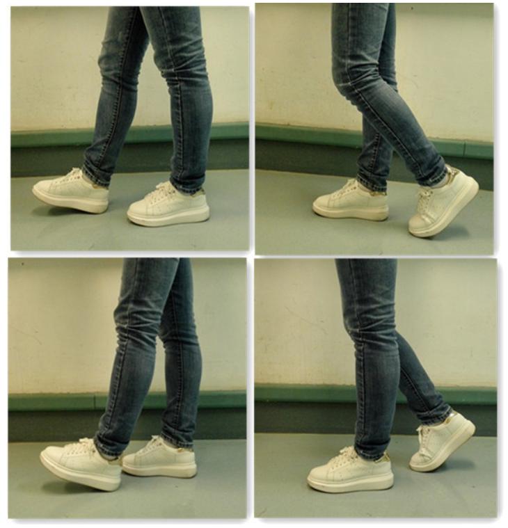 "Disease Science" How to correct the forward gait of Parkinson's ...