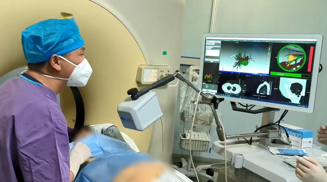 Accurately intervene in Yida Health intelligent surgery navigation ...