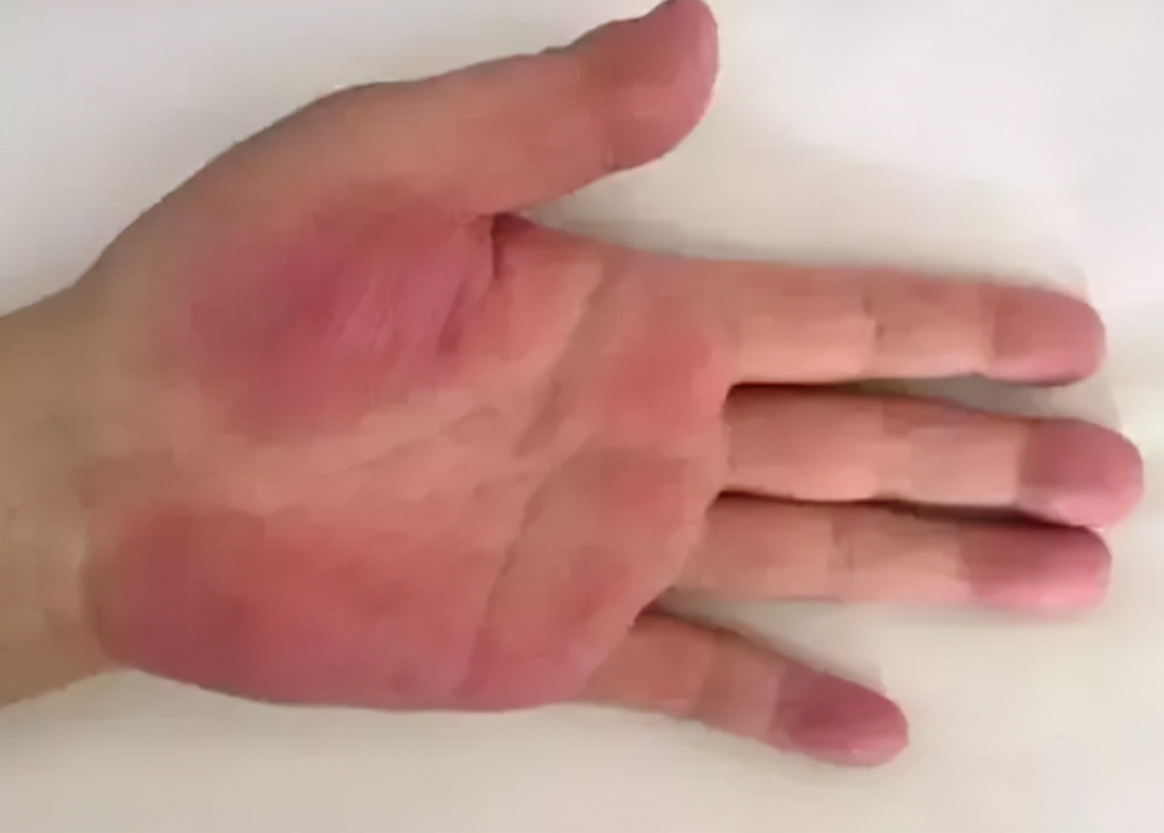 Is the liver good? First look at the skin?If there are 3 colors of "red ...