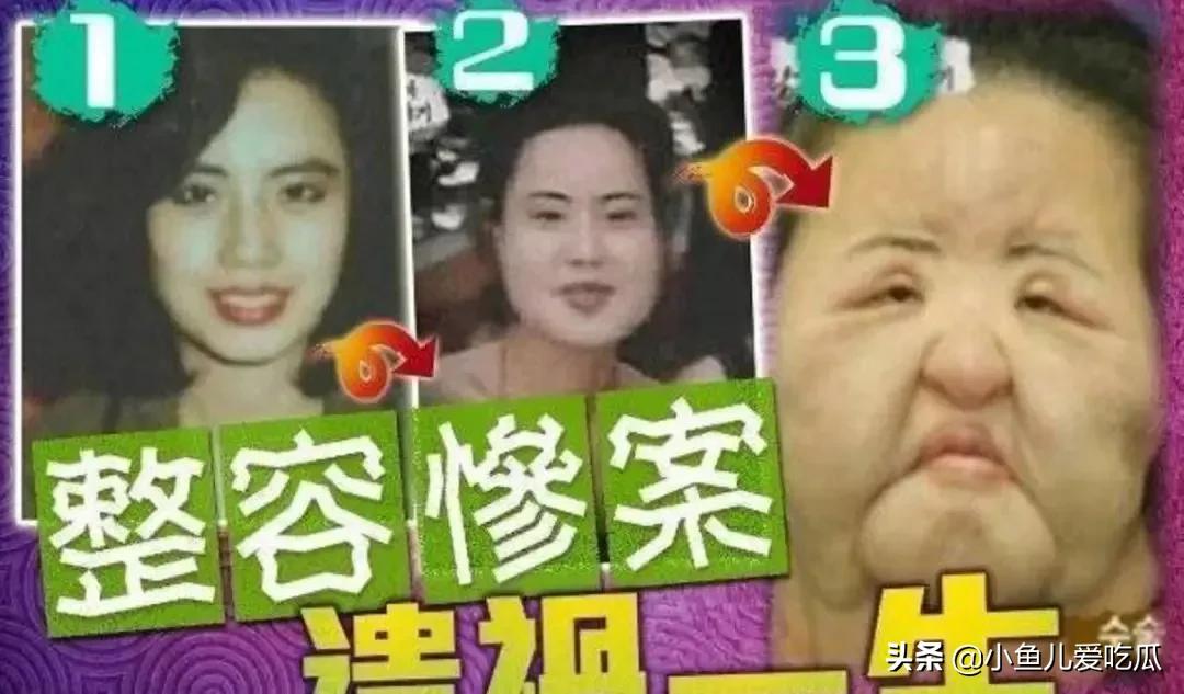 Han Huijing is addicted to plastic surgery, and abruptly changed ...