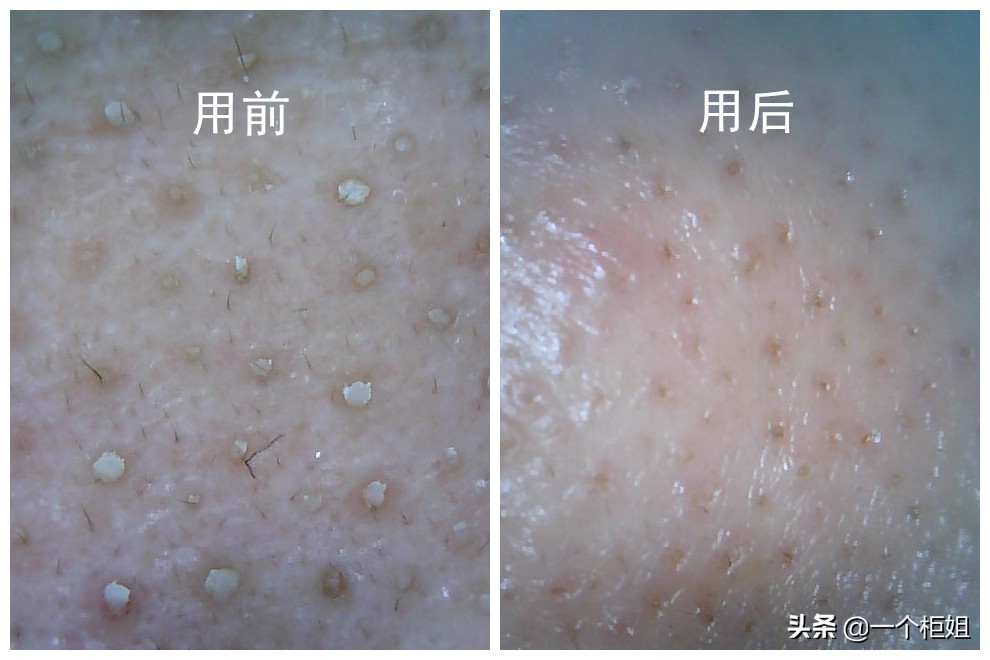 The pores on the nose are large, and yellow millet grains can be ...