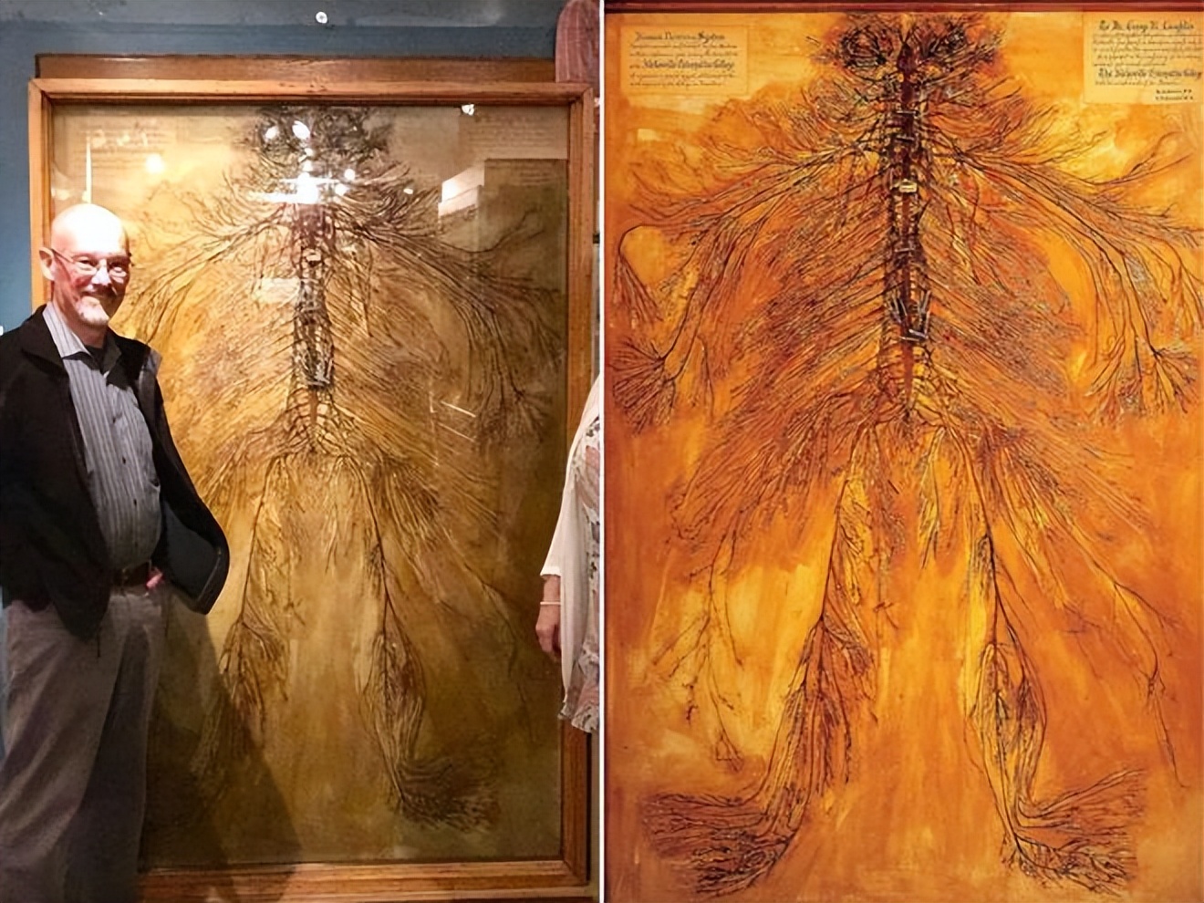 The largest testicle, the complete nervous system of human beings, the ...