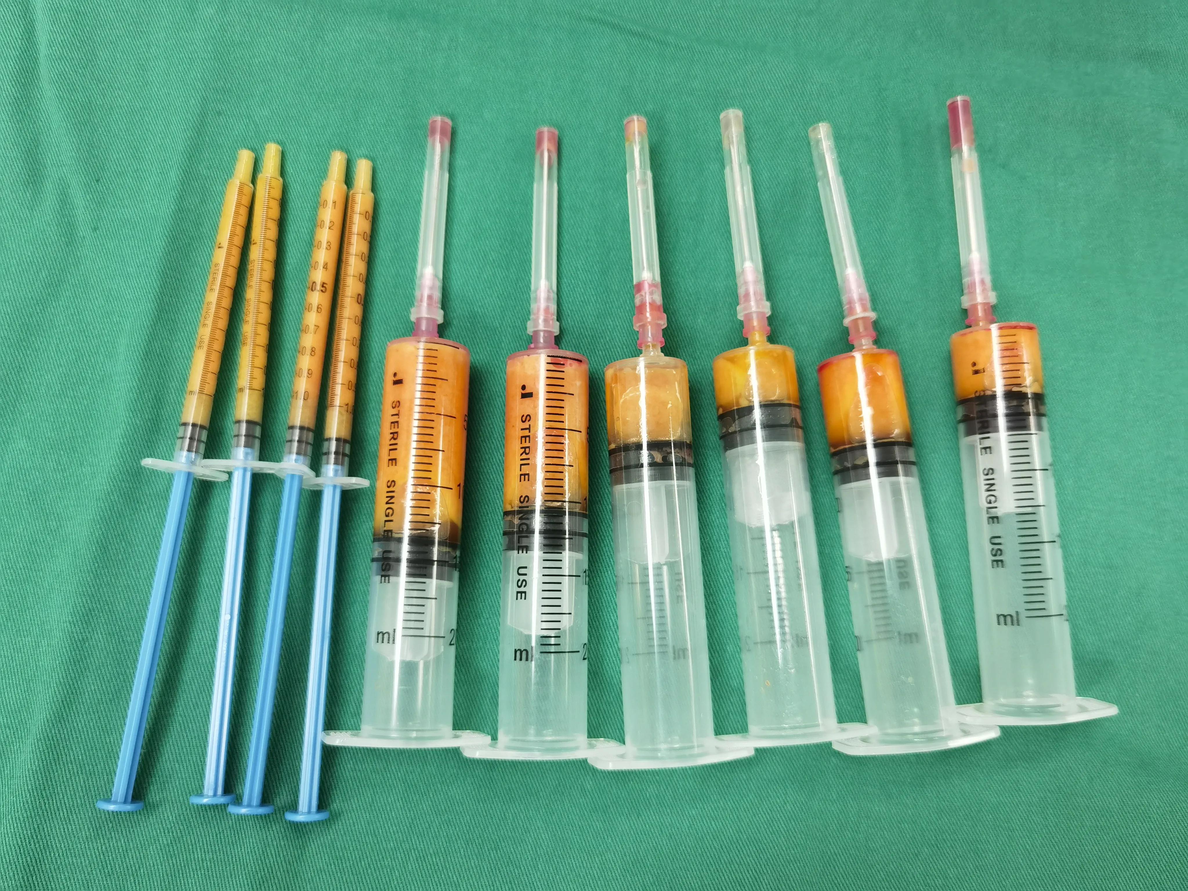 Autologous Fat Grafting for Facial Contouring - iNEWS