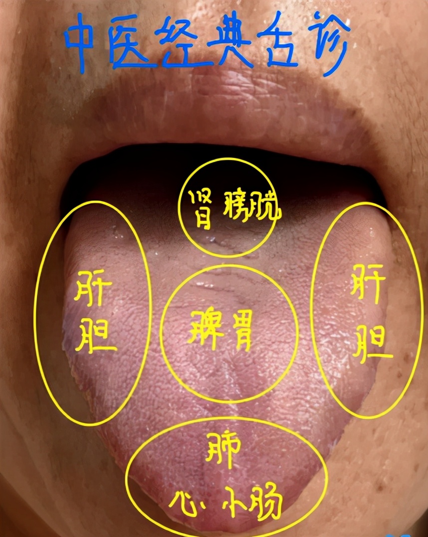 Five kinds of abnormal tongue analysis, simple study of traditional ...