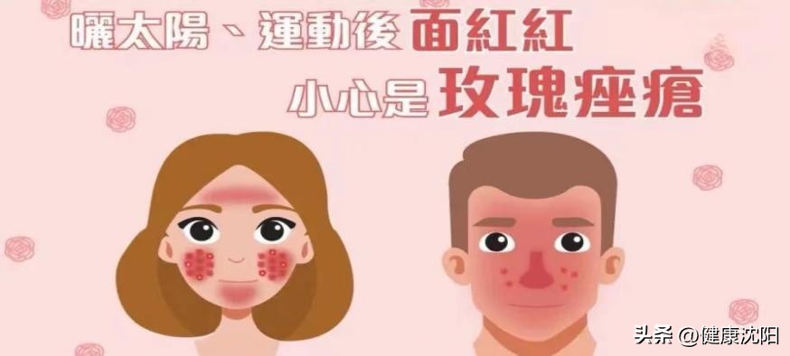 Prevent "big red face" from finding you in spring - iNEWS