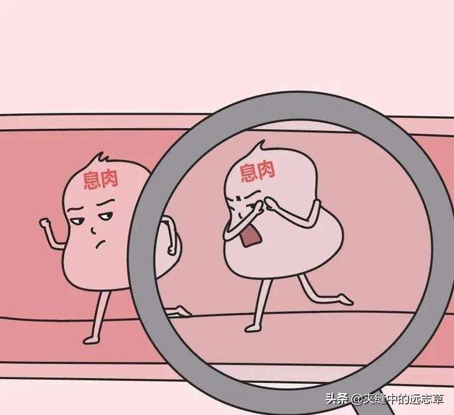 polyp?Send you four traditional Chinese medicines, all the way to ...