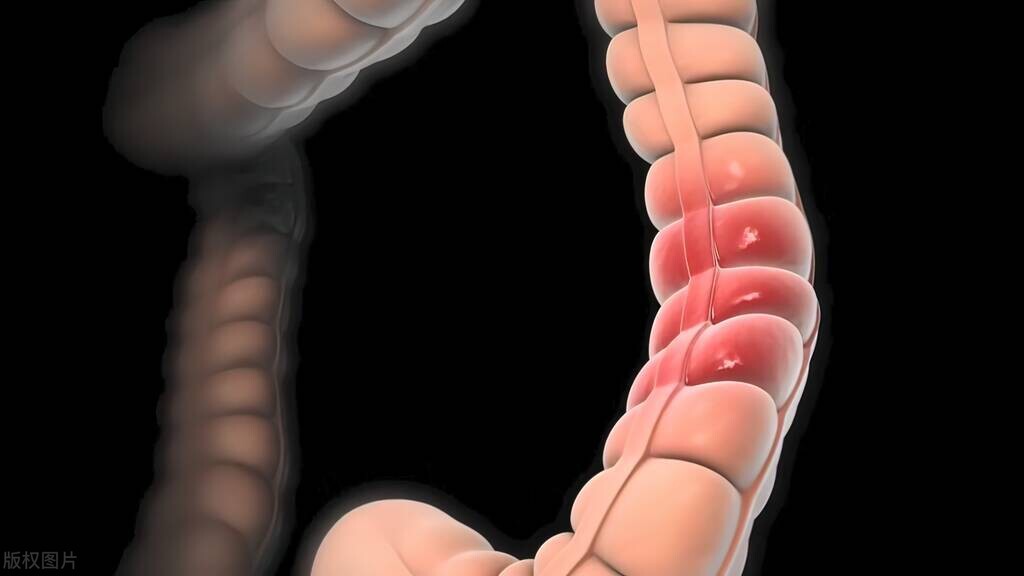 Both parents died of colon cancer, and he had thyroid cancer himself ...