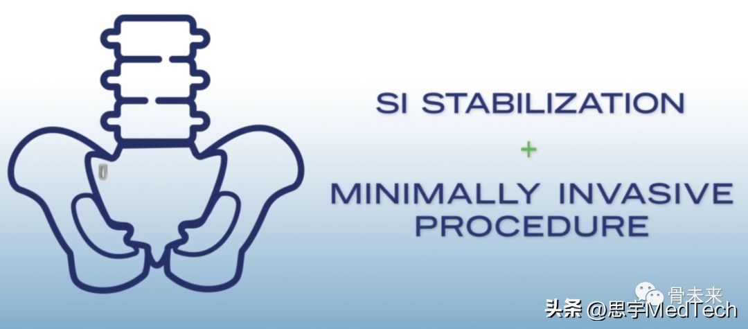 250 million financing! New minimally invasive orthopedic products - iMedia