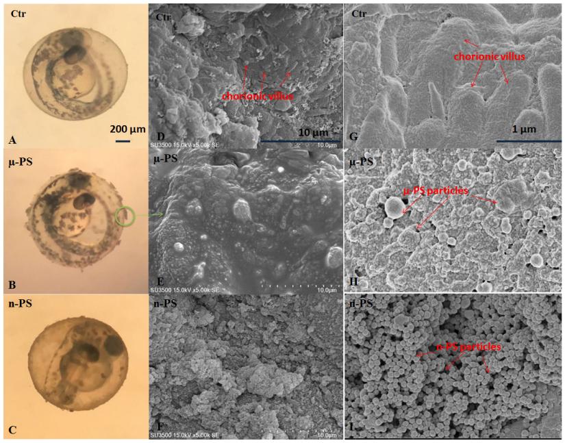 Exploring the Mysteries of Zebrafish Embryos with a Metabolomics ...