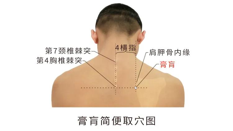 When the flu strikes, 8 acupoints can help you improve your ...