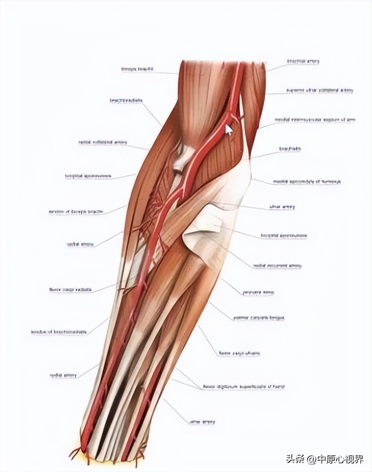Radial artery puncture II - iNEWS