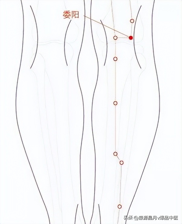 Sciatica: Three Acupuncture Points and Detailed Needling Techniques - iMedia