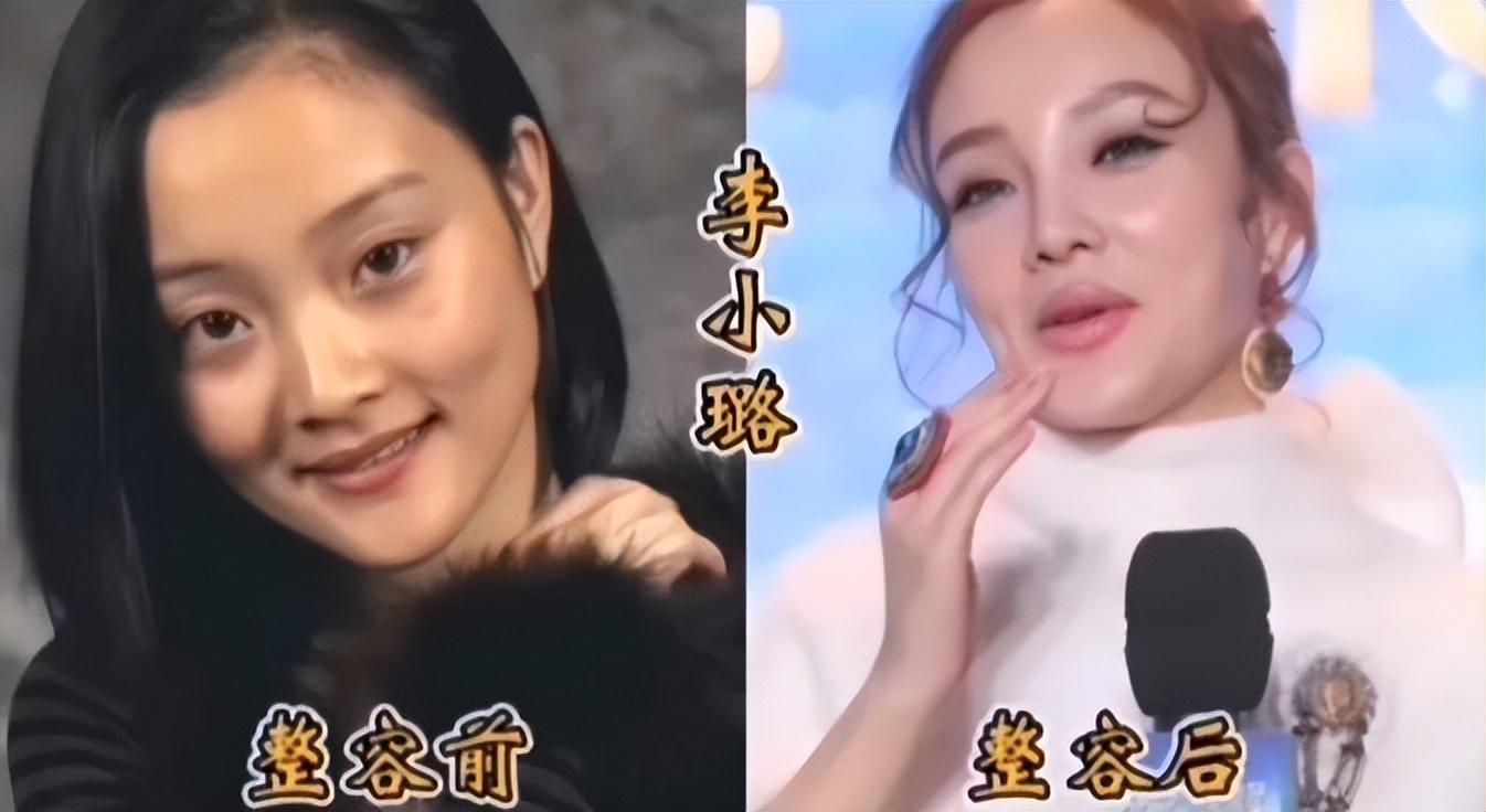 Comparing actresses before and after plastic surgery, Li Bingbing and ...