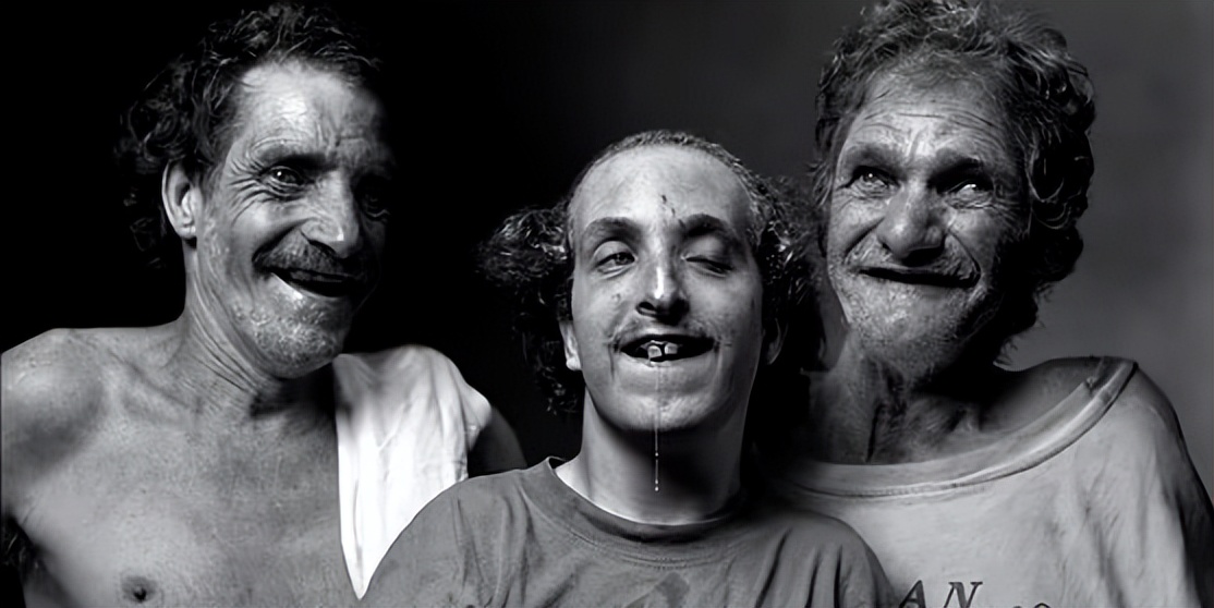 The scariest incest family in the United States: Facial deformities ...