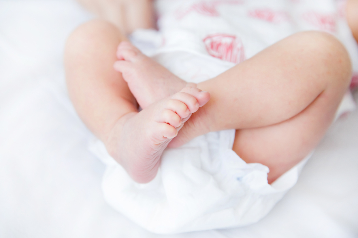 The baby's hip lines are asymmetrical, which may be caused by these two ...