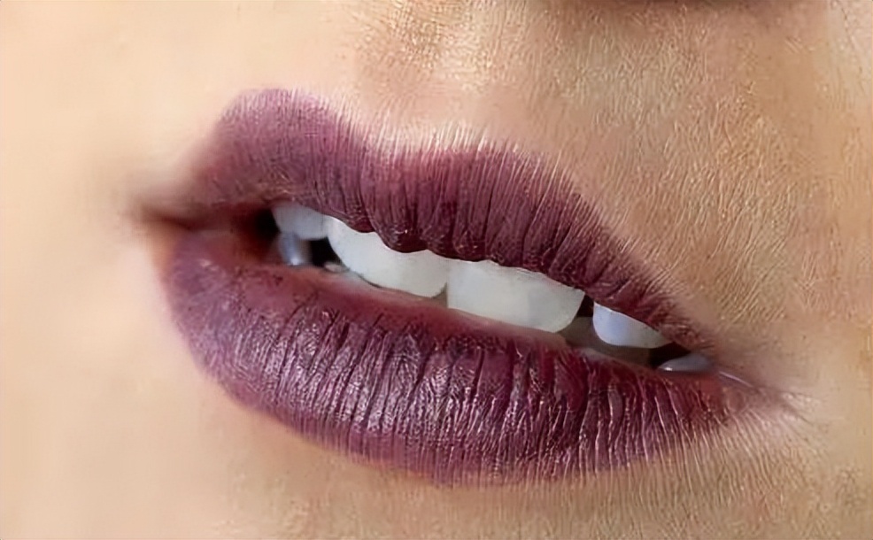 Look at lip color, know health: lips are the barometer of the body ...