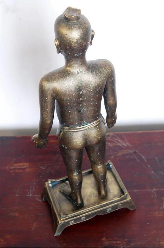 An acupuncture bronze figure from the Northern Song Dynasty appears in ...