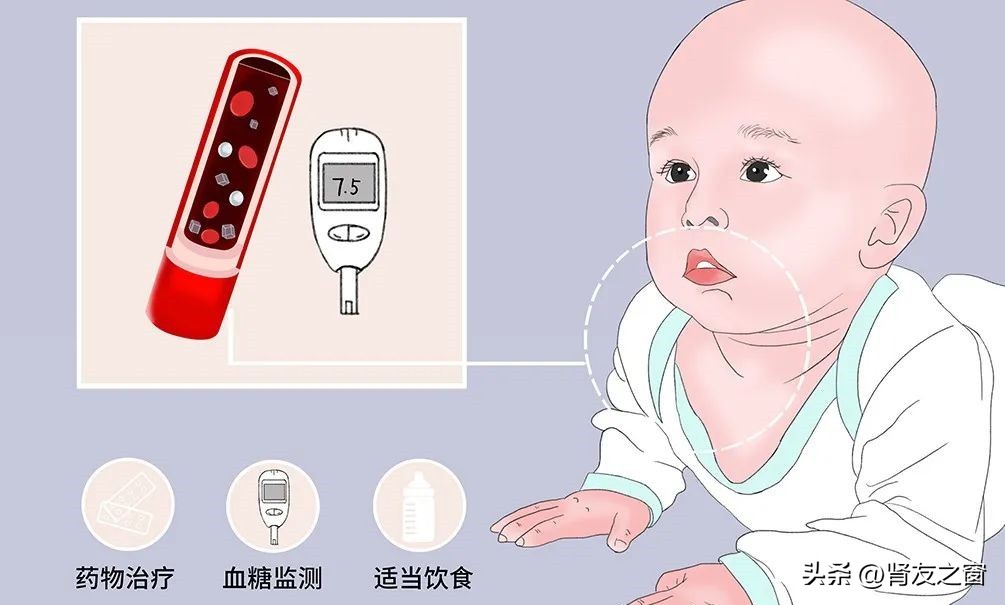 neonatal diabetes - iNEWS