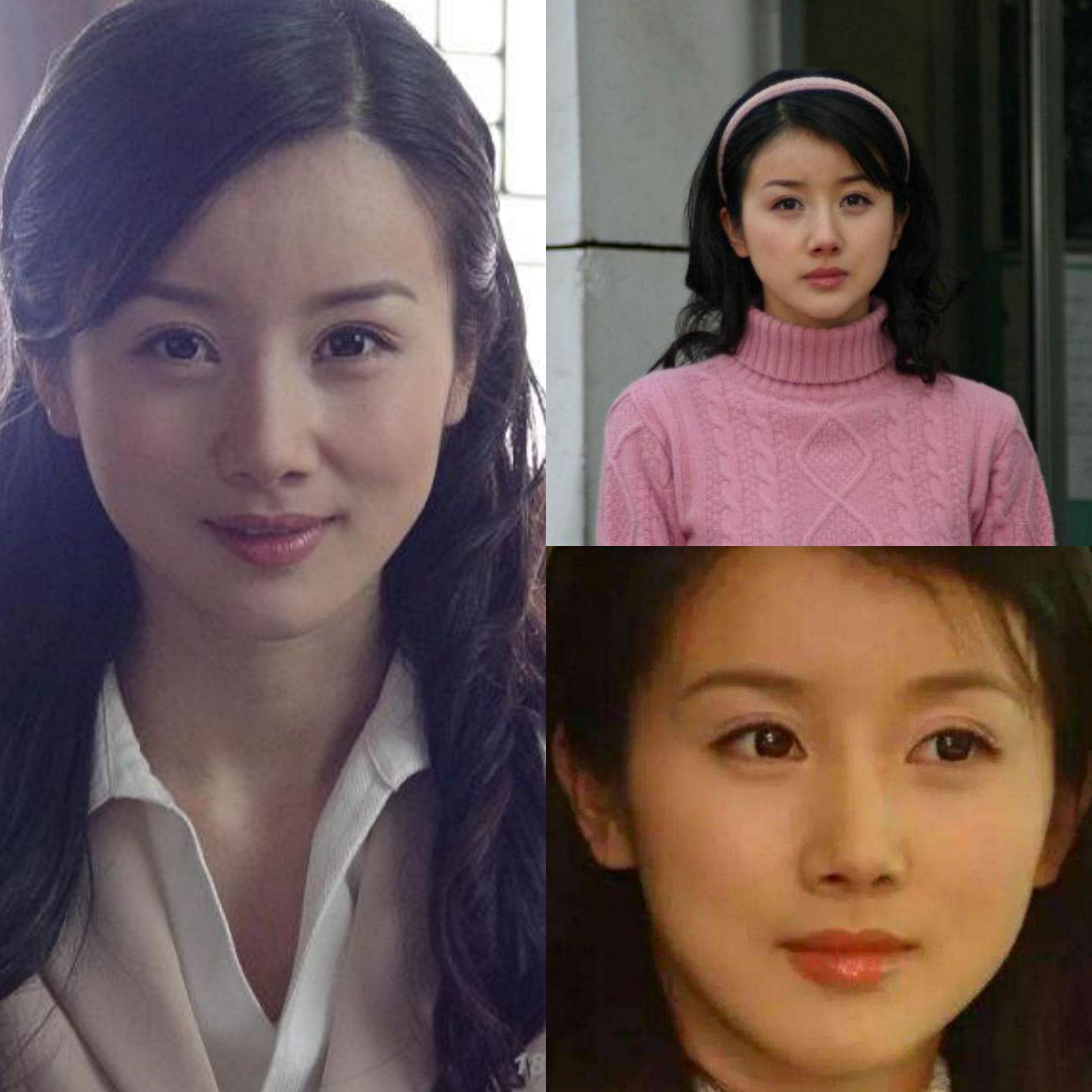 Because plastic surgery ruined their careers, changed their face beyond ...