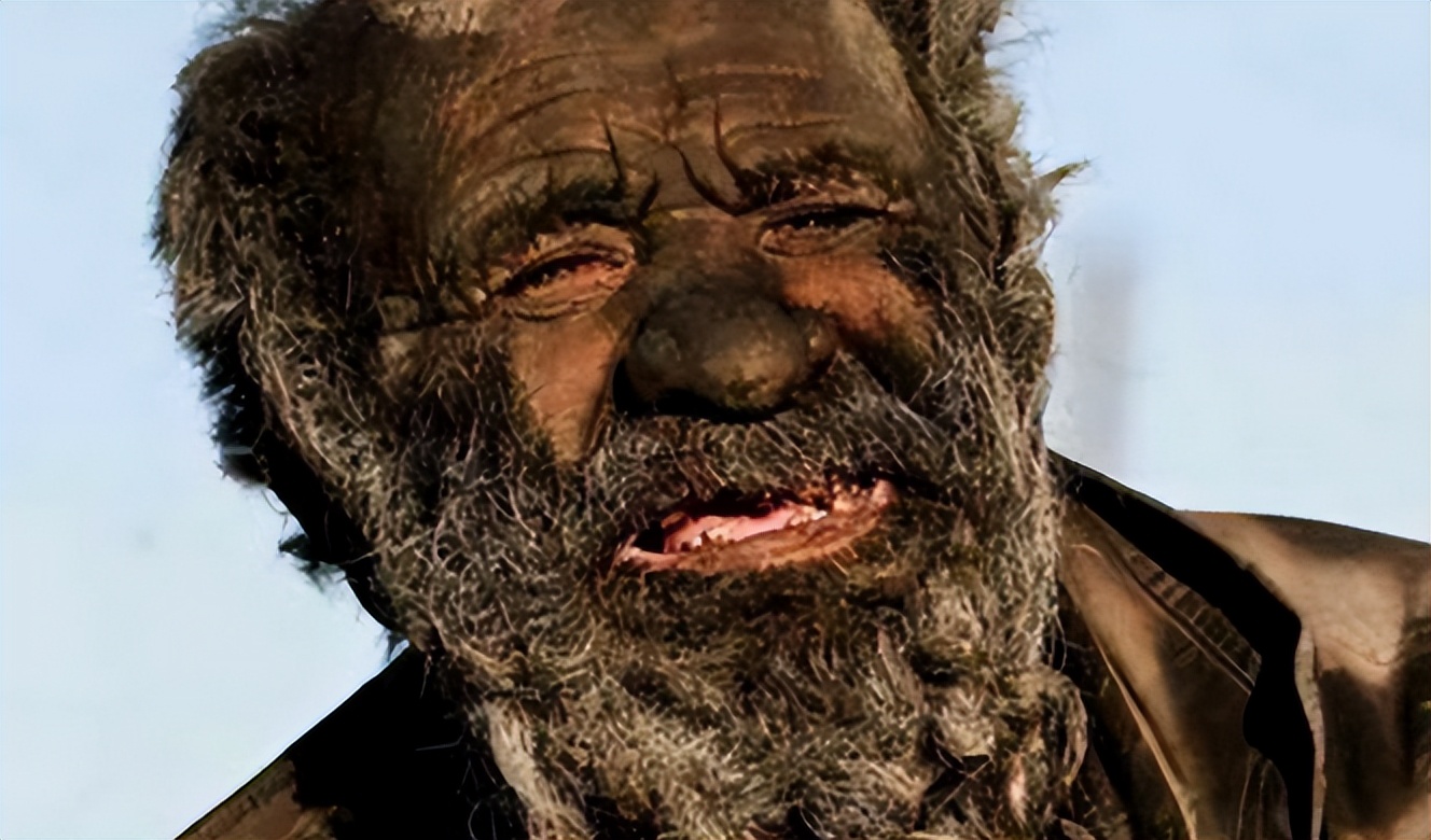 Guinness records the "dirtiest" man Haji: He didn't take a bath for ...