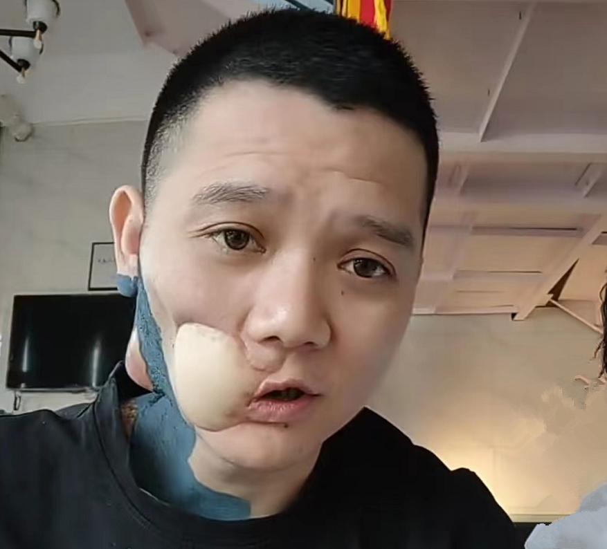 36-year-old singer Fu Song died of oral cancer!Chewed betel nut for 6 ...