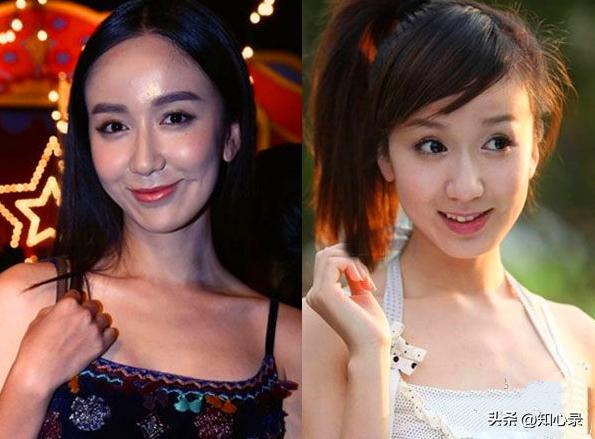 Don't use plastic surgery!Look at these short-lived actresses, they ...