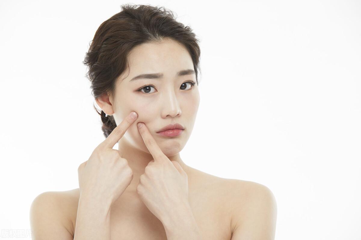 Cui Xue Fu: You have been removing acne, why do acne still come and go ...