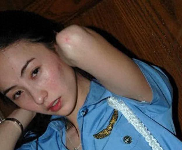 Cecilia Cheung was deeply hurt by the Edison Chen nude photos scandal, and some of the photos ...