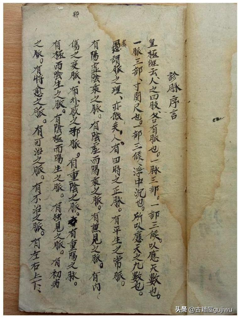 The ancient book of TCM pulse science "Diagnosing the pulse and copying ...