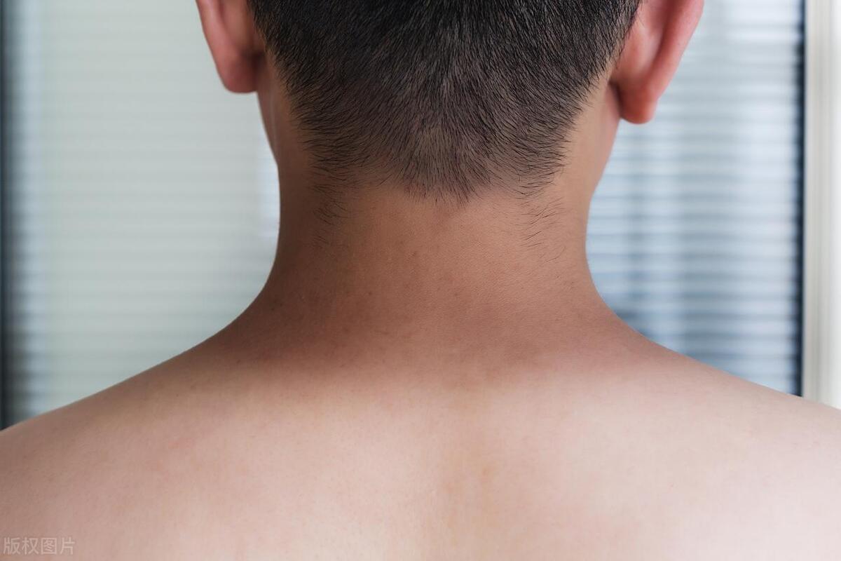 What should I do if my skin is hot and red after sun exposure? - iNEWS