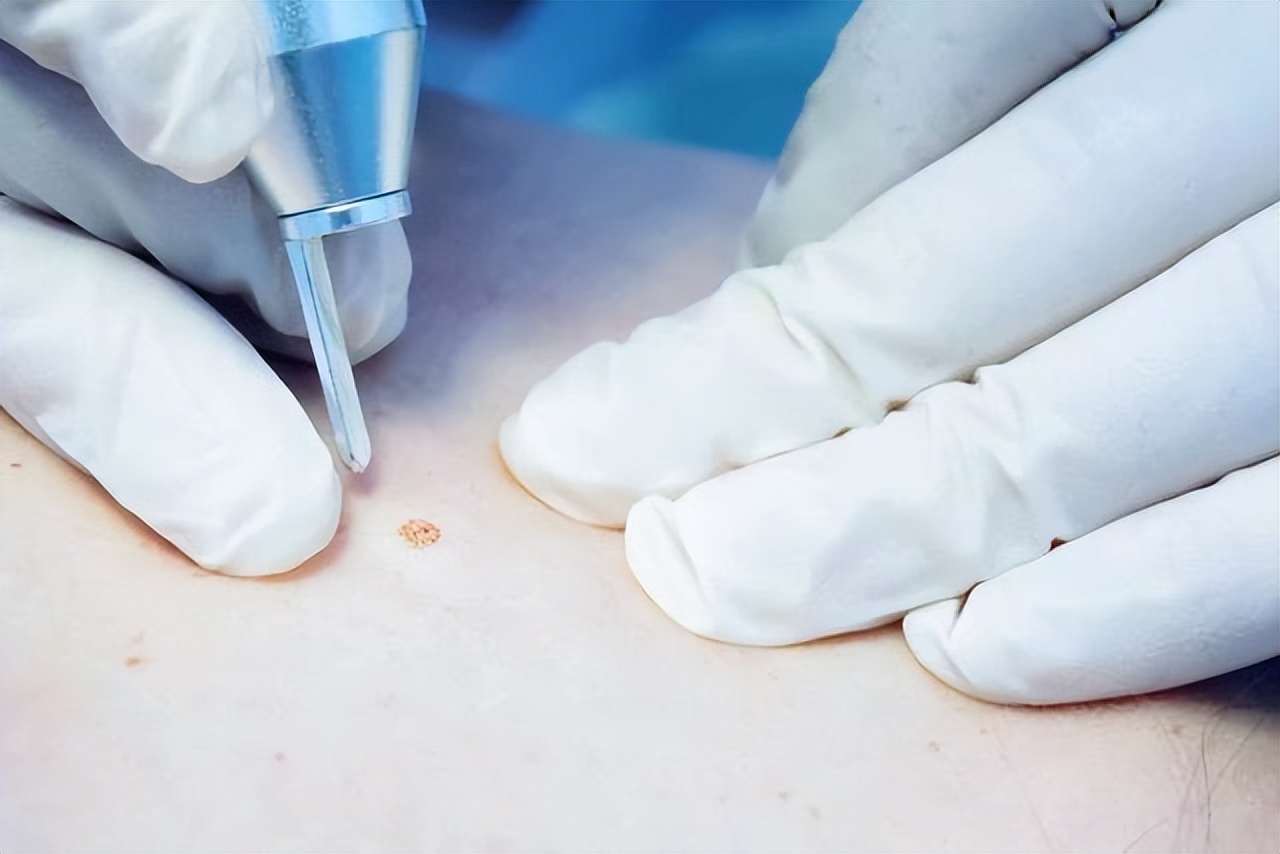 What is the reason for the "small meat particles" in the neck and ...