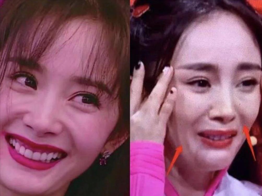 Skeleton body, addicted face, exaggerated porcelain teeth, what ...